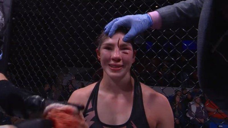Ngeri! Petarung MMA Wanita Ini Bermandikan Darah Usai Dihajar Lawannya ...